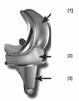 Pose d'une Prothèse totale du Genou à Villefranche et Lyon